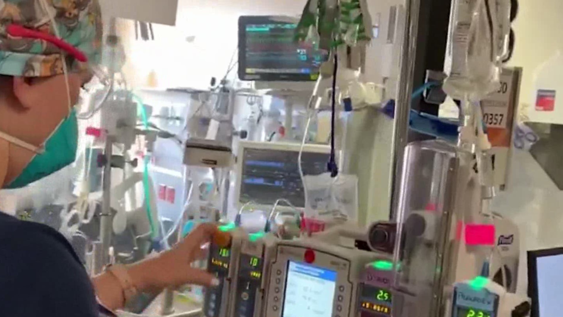 What is ECMO and how is it saving the lives of some of the sickest ...