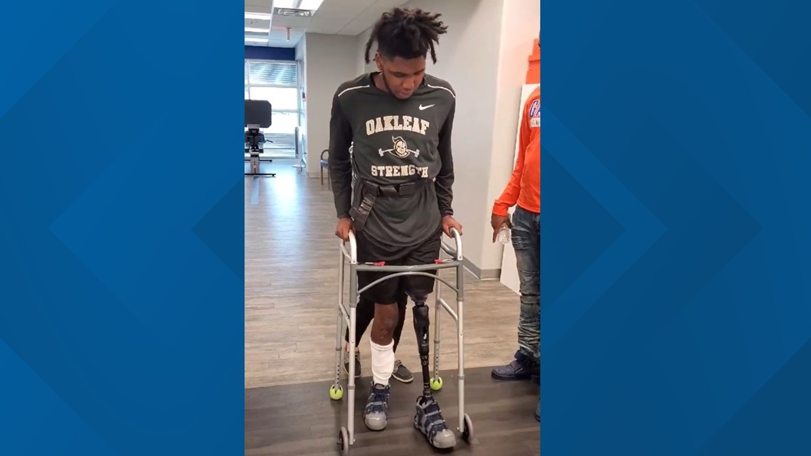 Teen learning to walk after losing leg in deadly Florida crash ...