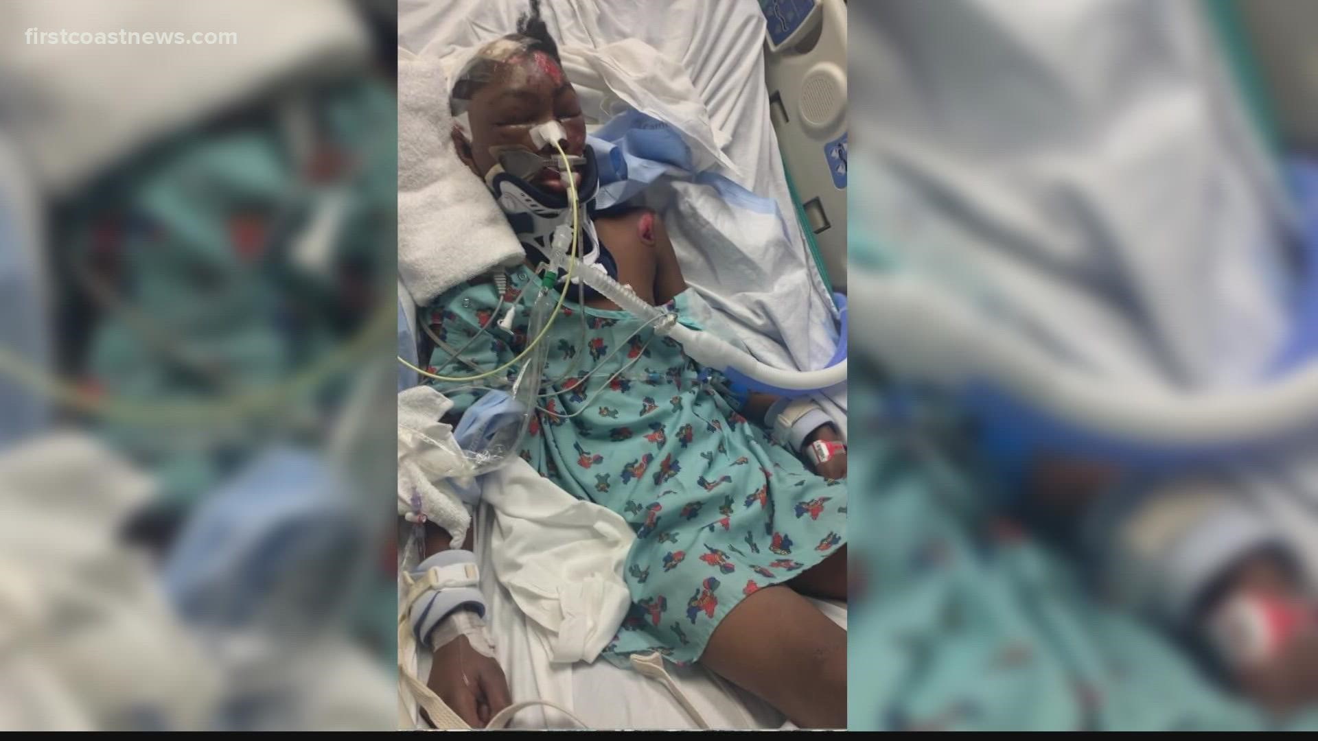 Jacksonville boy has brain surgery on 11th birthday after hit-and-run ...