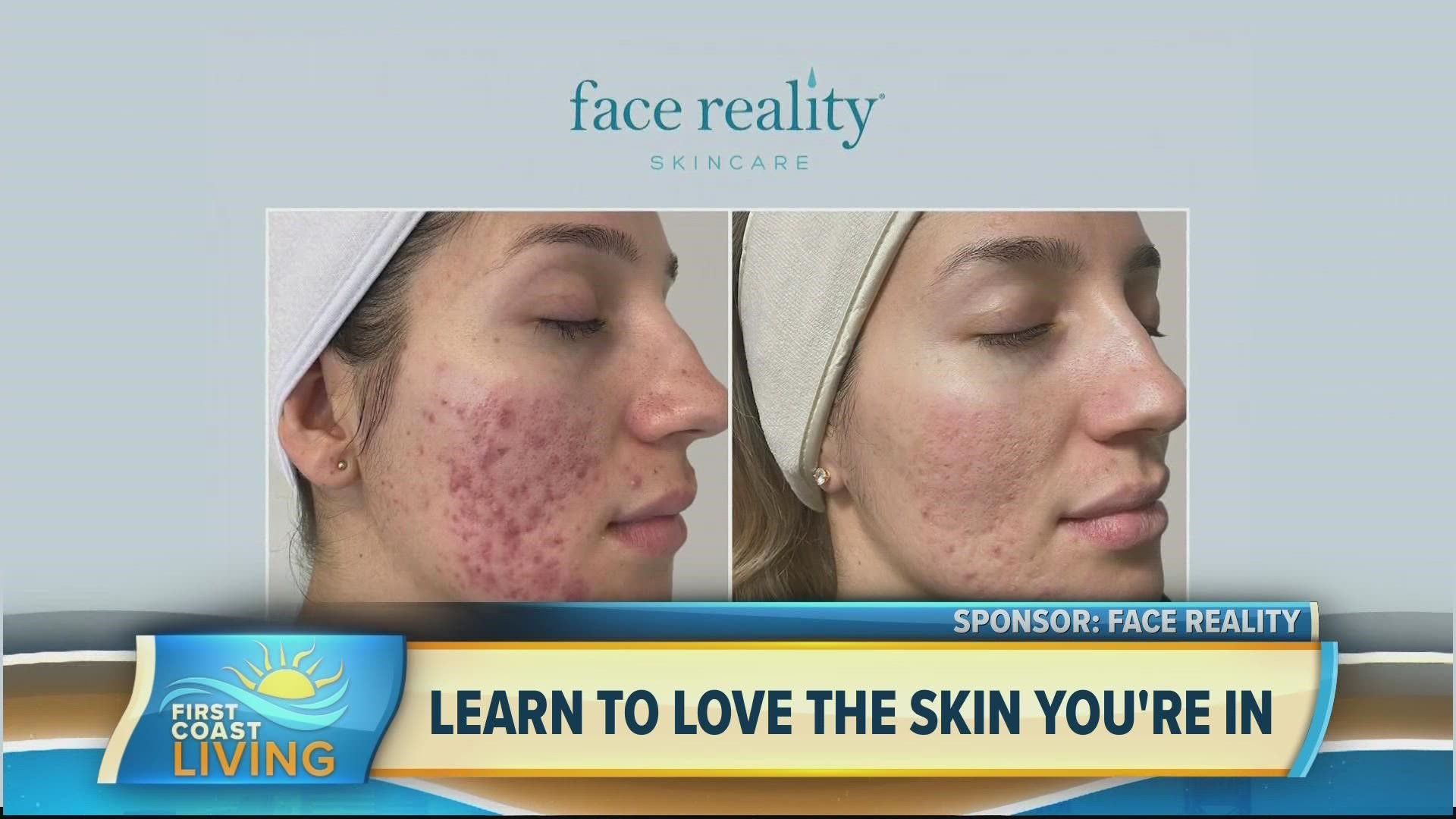 Learn to love the skin you're in (FCL June 7, 2022) | firstcoastnews.com