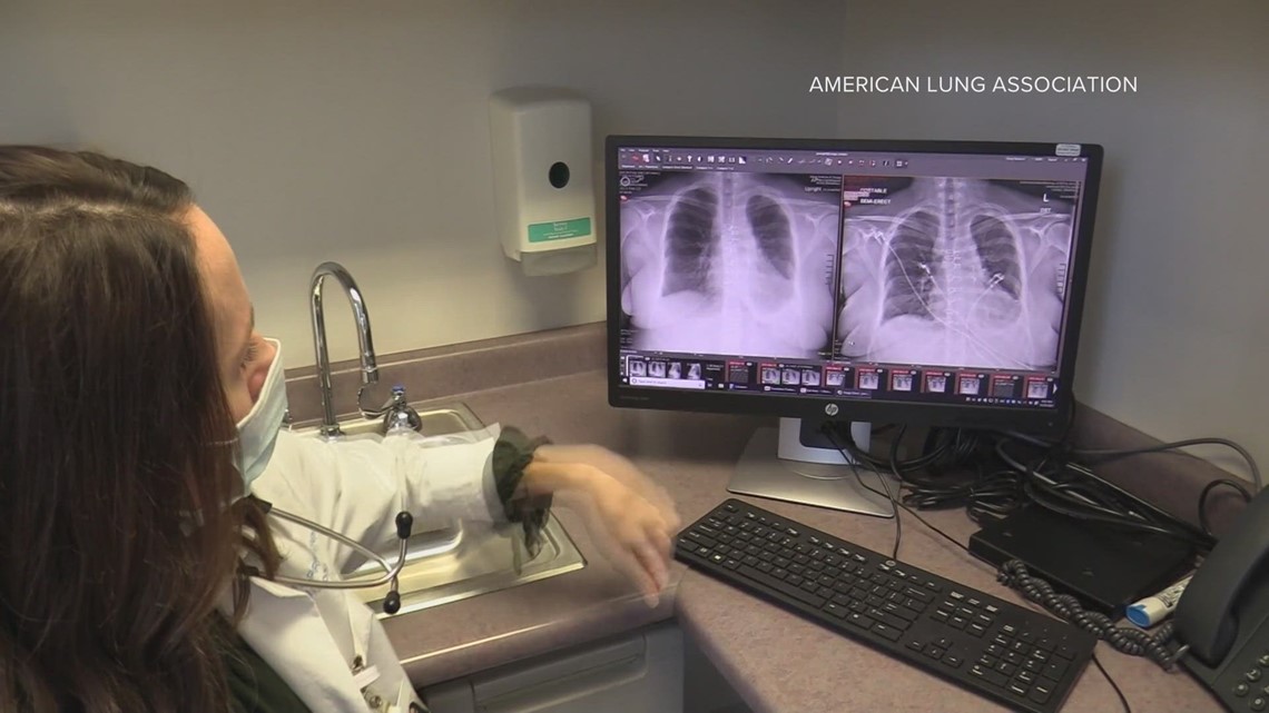 Here's how to get paid in American Lung Association's new study ...