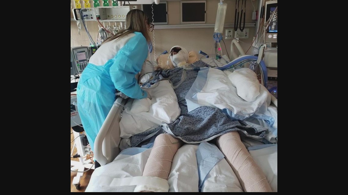 Driver that allegedly left man with 90% burns has extensive history of ...