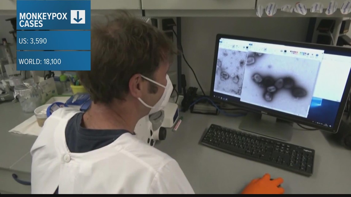 CDC now reports the US has one of the highest levels of monkeypox in ...