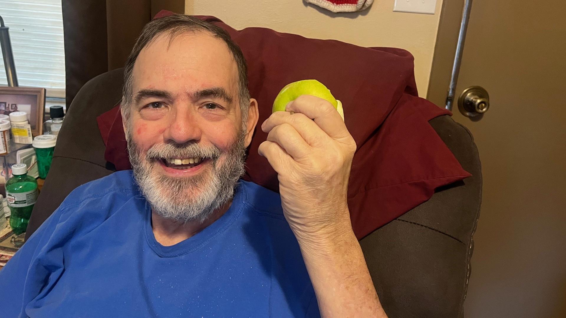 Finally, Ed can bite into an apple. How you could also get free dental ...