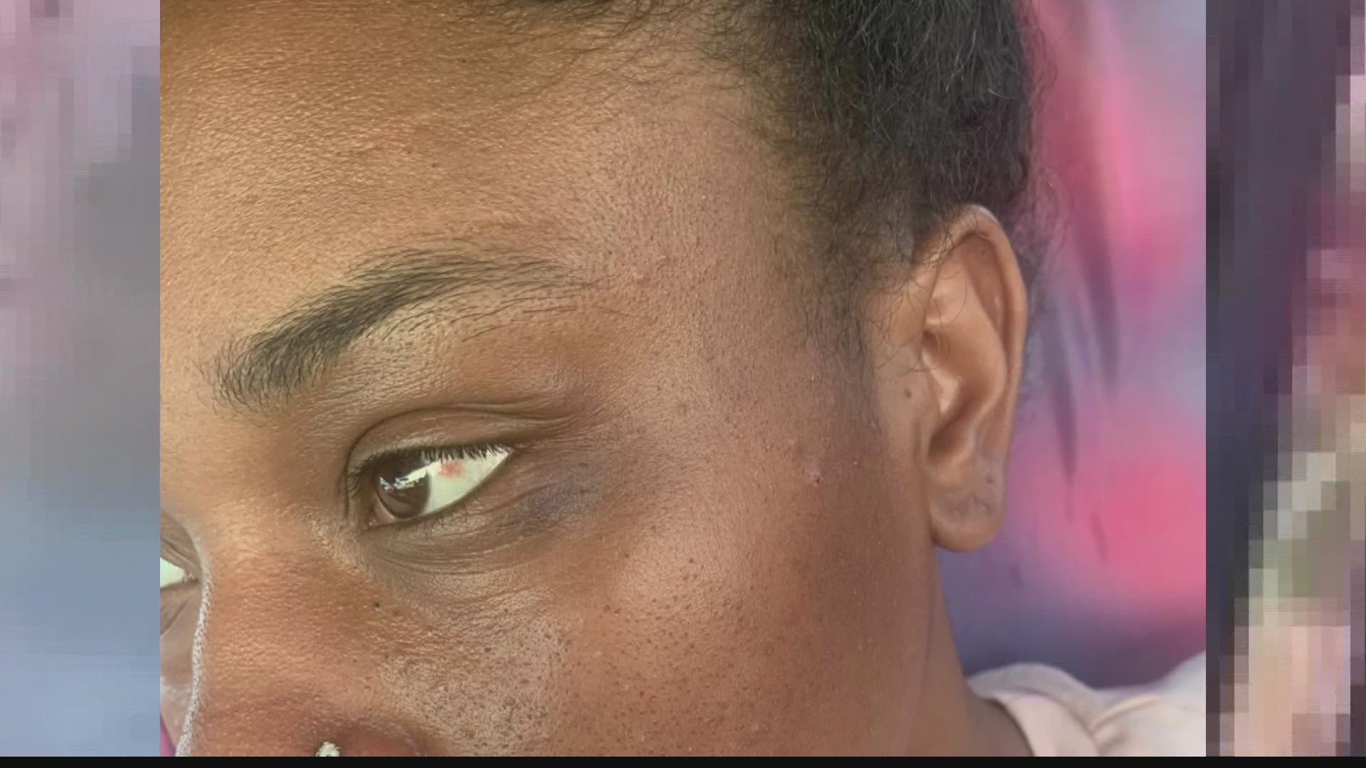 Alleged Racially Motivated Attack At Jacksonville Gas Station Leaves