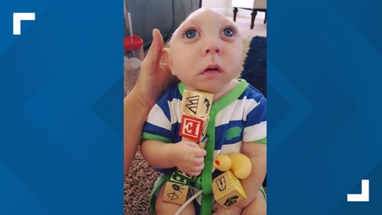 Jaxon Buell dies after years of beating the odds | firstcoastnews.com